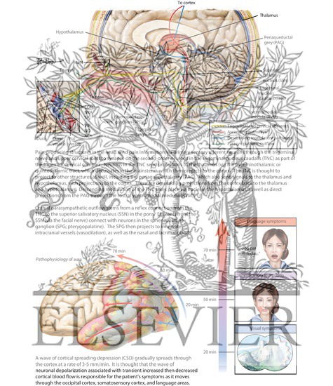 Migraine Pathophysiology