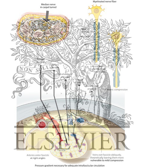 Chronic Nerve Compression