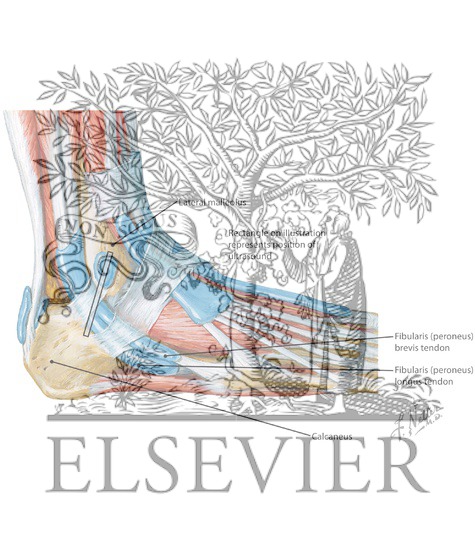 Fibular (Peroneus) Tendons at Ankle