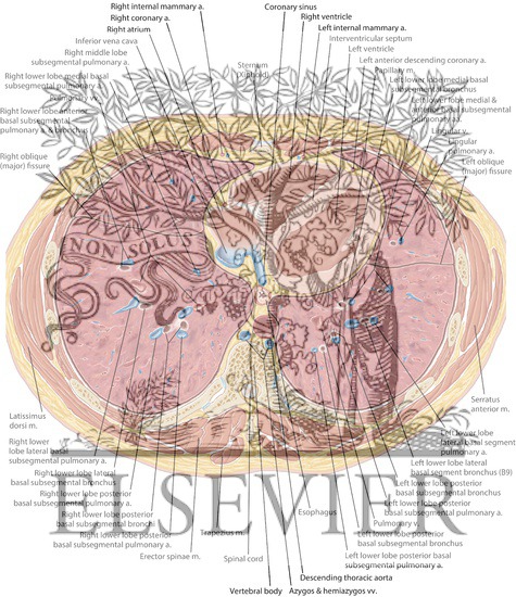 Soft Tissue and Lung Axial 32