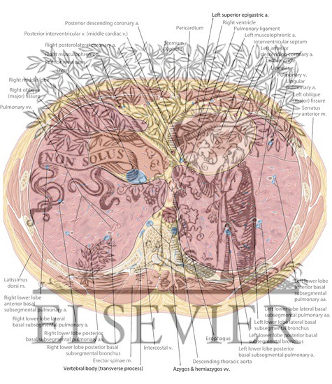 Soft Tissue and Lung Axial 36