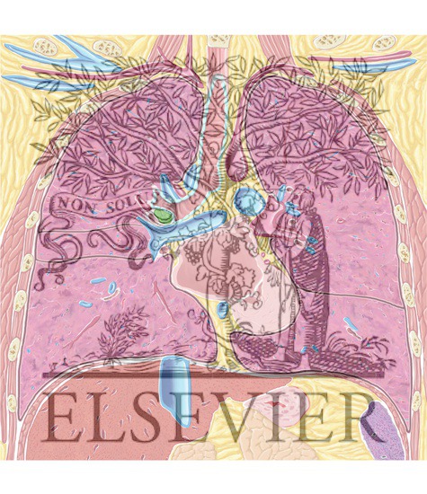 Soft Tissue and Lung Coronal 18