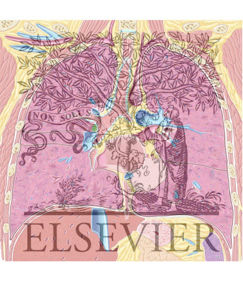 Soft Tissue and Lung Coronal 19