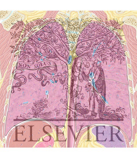 Soft Tissue and Lung Coronal 26