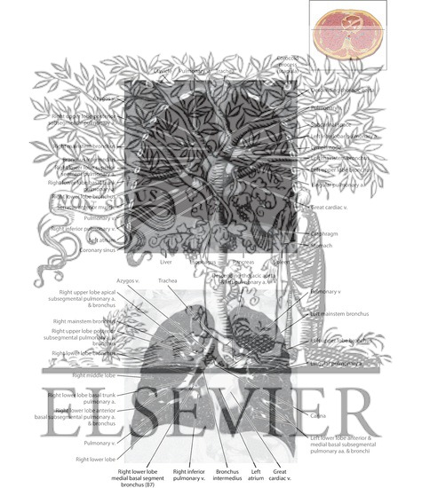 Soft Tissue and Lung Coronal 21