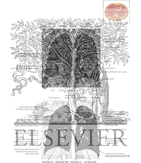 Soft Tissue and Lung Coronal 26