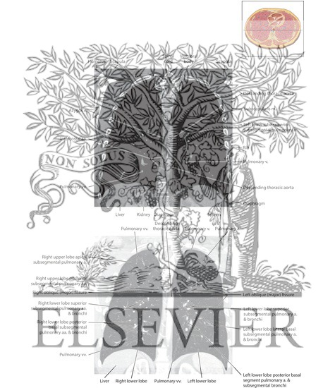 Soft Tissue and Lung Coronal 28