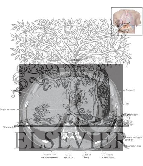 Cisterna Chyli/Thoracic Duct Axial 1