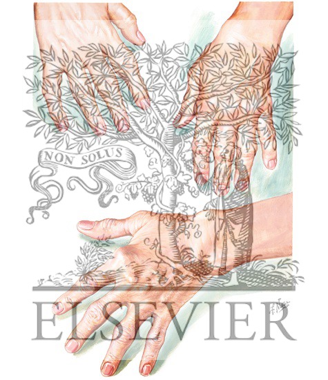 Early and Moderate Hand Involvement In Rheumatoid Arthritis
