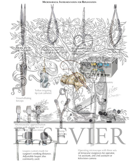 Microsurgical Instrumentation for Replantation