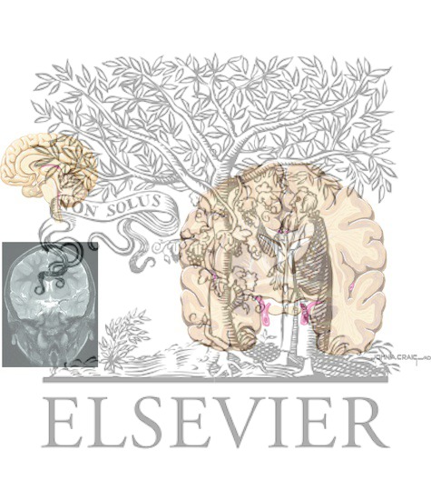 A. Coronal Sections Through the Forebrain: Level 3 - Anterior ...