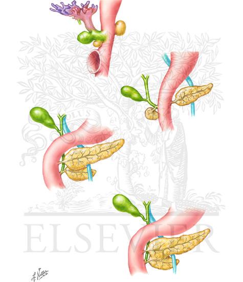 Development of the Gallbladder and Bile Ducts
