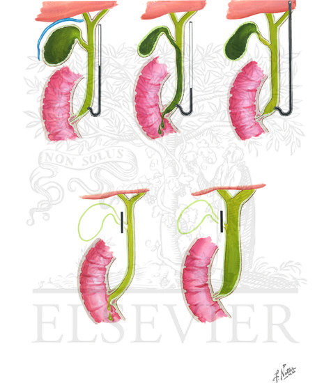 Function of Gallbladder and Choledochoduodenal Sphincter