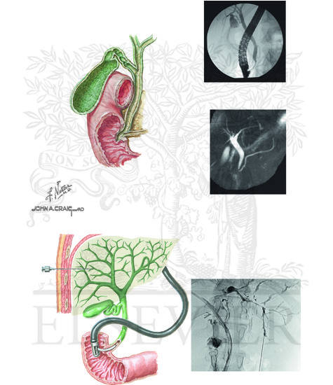 Invasive Imaging Modalities and Minimally Invasive Interventions of the ...
