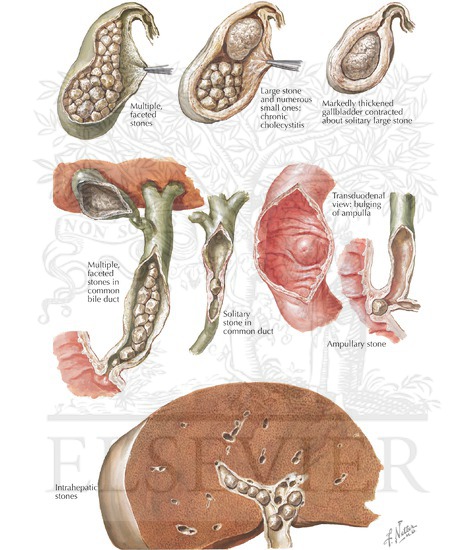 Gallbladder Anatomy Netter