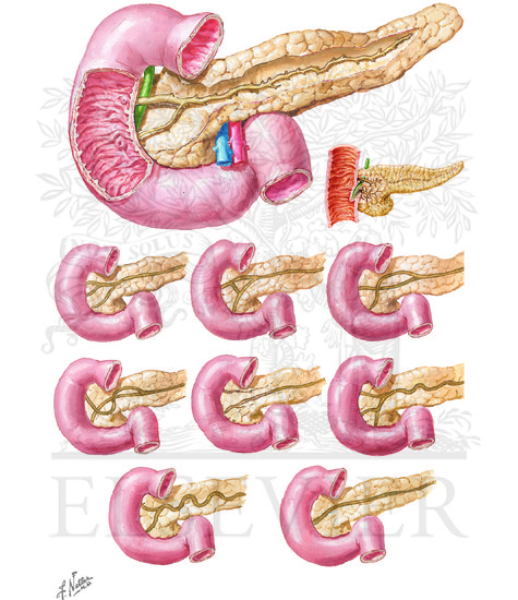 Pancreatic Ducts and Variations