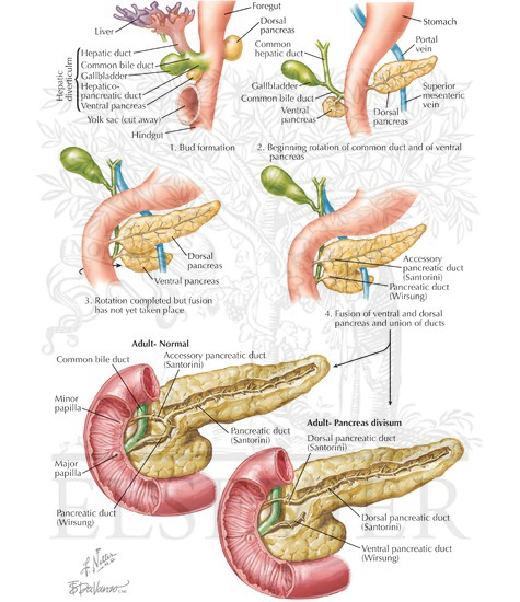 Congenital Anomalies of Pancreas