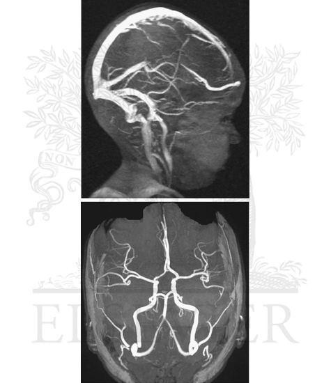 Cranial Imaging (MRV and MRA)