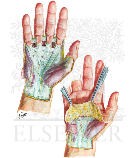 Wrist and Hand: Superficial Palmar Dissections Wrist and Hand: Superficial Palmar Dissections