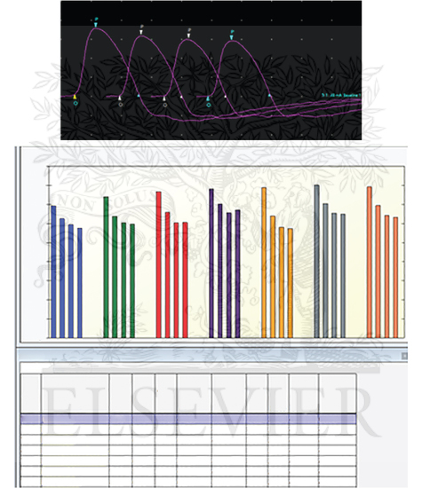 Repetitive Motor Nerve Stimulation: PATIENT WITH MYASTHENIA GRAVIS