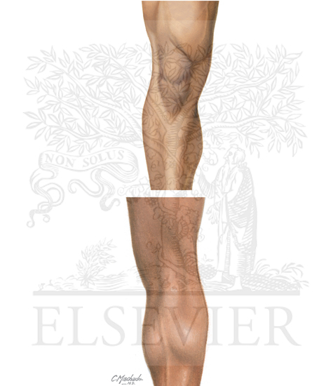 Topographic Anatomy of the Knee