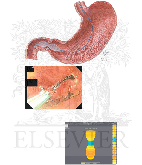 Watermarked preview of unlabeled image: Diagnostic Tests in Gastric ...