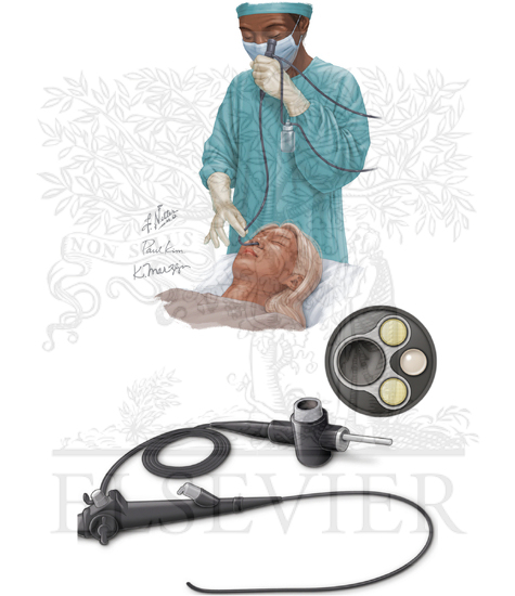 flexible bronchoscopy