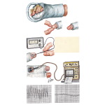 Postoperative Dressing and Monitoring of Blood Flow