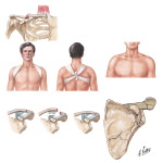 Fracture of Clavicle and Scapula