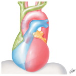 Radiology and Angiocardiography