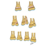 Injury to Growth Plate (Salter-Harris Classification, Rang Modification)