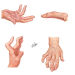 Physical Examination of the Hand