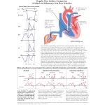 Doppler Flow Studies: Comparison of Mitral and Pulmonary Vein Flow ...