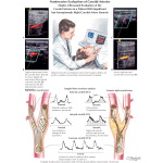 Noninvasive Evaluation of Carotid Arteries