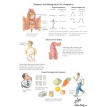 Diagnosis and Management of Constipation
