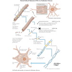 Paired Helical Filaments (PHFs) in Alzheimer's Disease