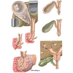 Neoplastic Obstruction of the Bile Ducts