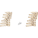 Radiographic Signs of Cervical Spine Instability