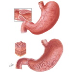 Stomach