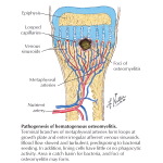 Pathogenesis of Hematogenous Osteomyelitis