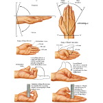 Measurement of Wrist Motion and Finger Motion, Lack of Finger Flexion ...