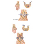 Surgical Approaches to the Wrist
