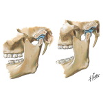 Temporomandibular Joint Mechanics
