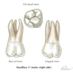 Maxillary 1st Molar (Right Side)