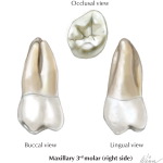 Maxillary 3rd Molar (Right Side)