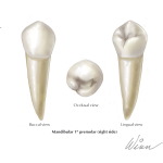 Mandibular 1st Premolar (Right Side)