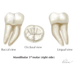 Mandibular 3rd Molar (Right Side)