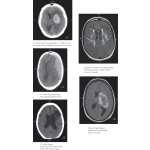 Neurodiagnostic Tests Used for Evaluation