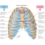 Thoracic Cage Injuries