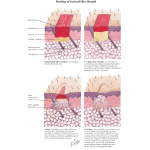 Healing of Excised Skin Wound